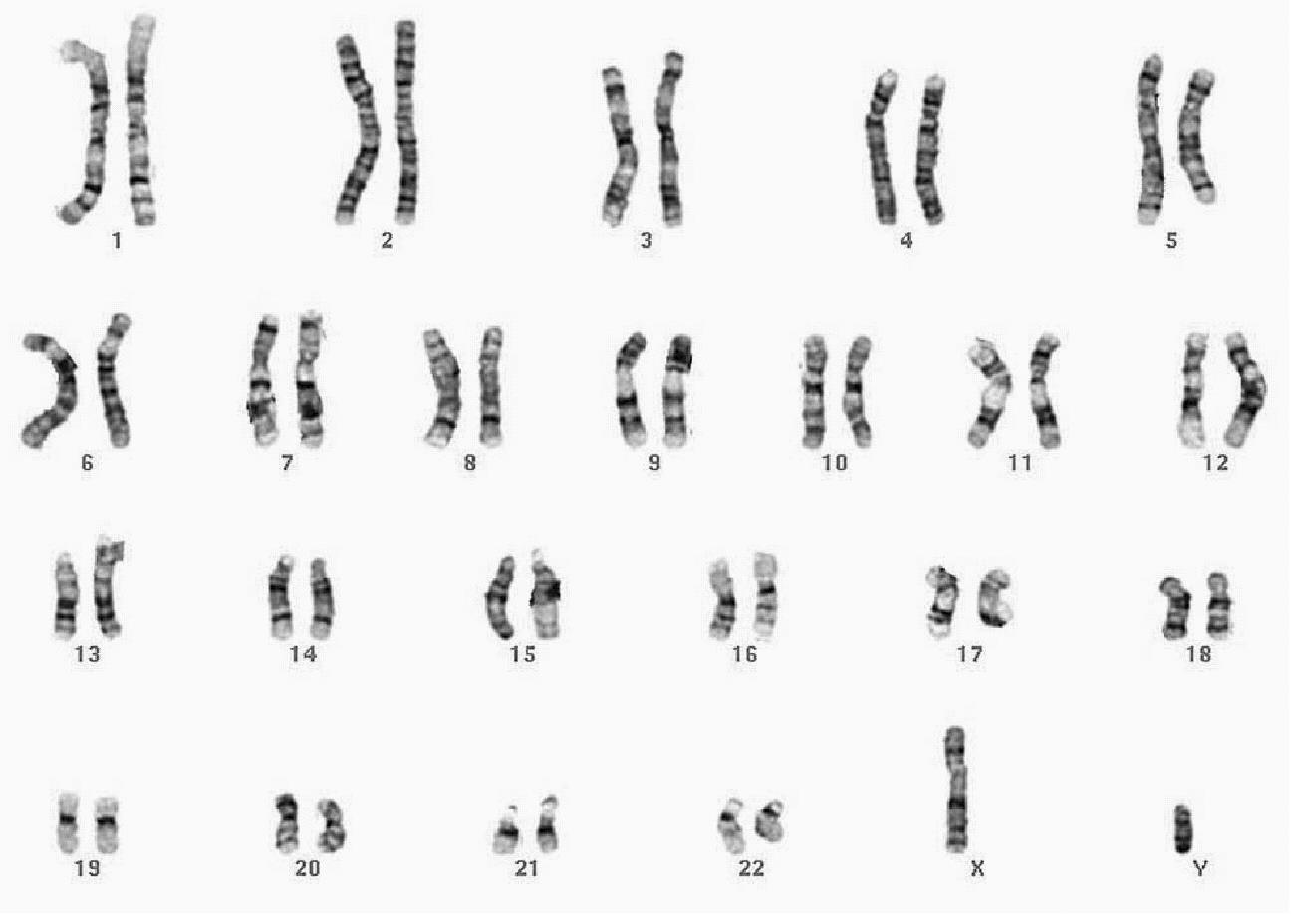 Transmitere genetică - Cardiomiogen.ro